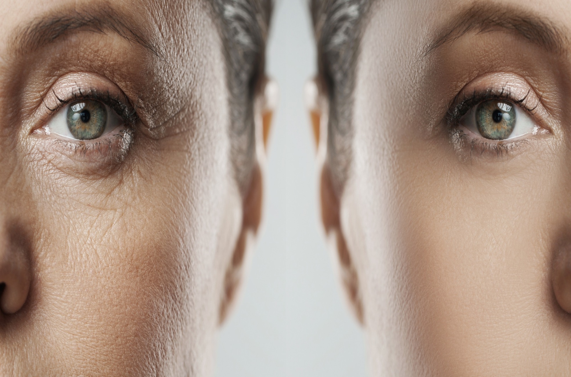 IPL face skin rejuvenation and collagen stimulation - Himalaya Salt ...